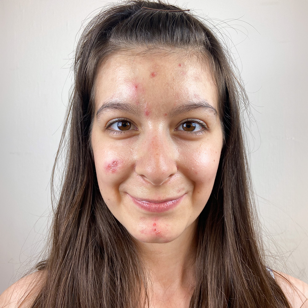 Balanced Skin | Filabé of Switzerland