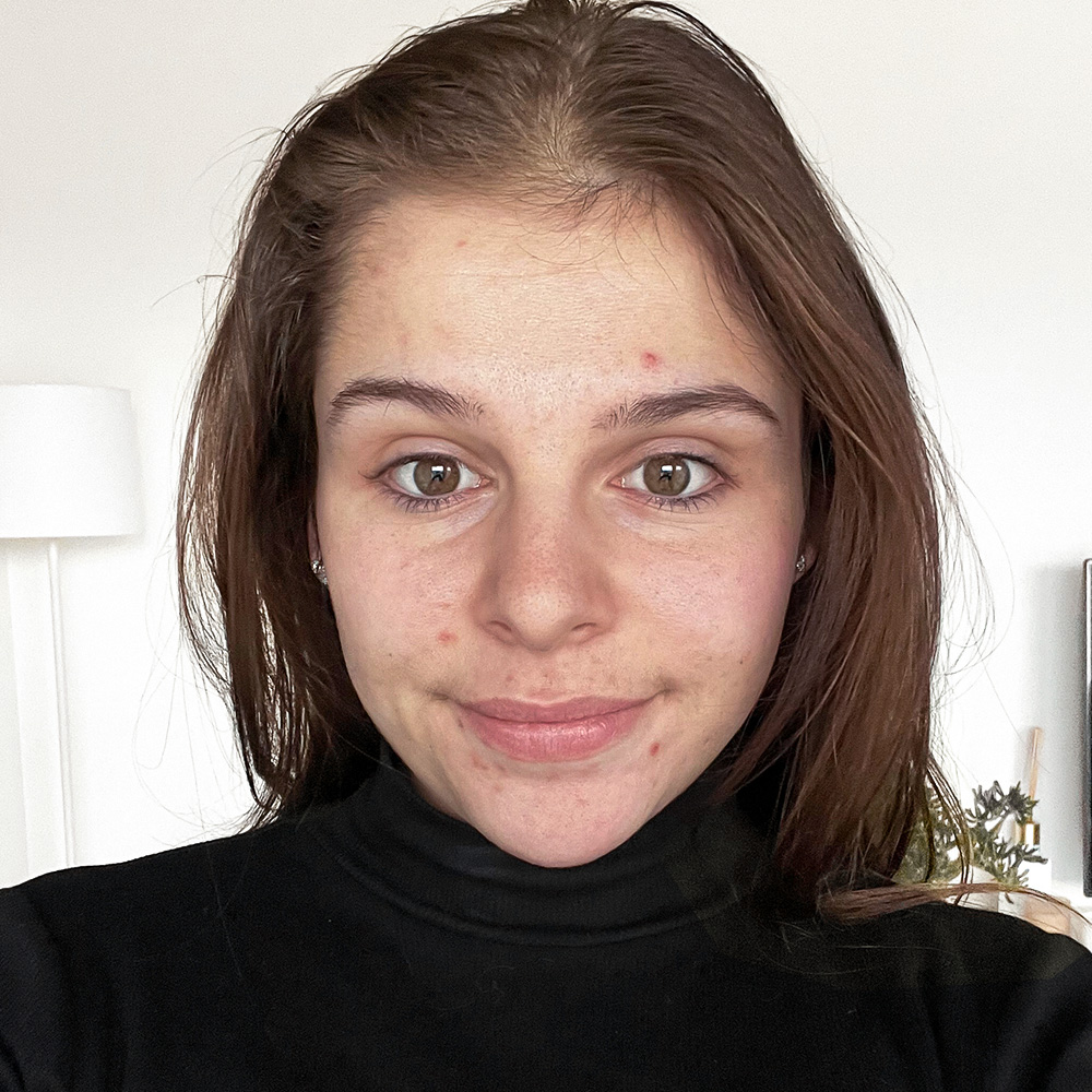 Mixed Skin | Filabé of Switzerland